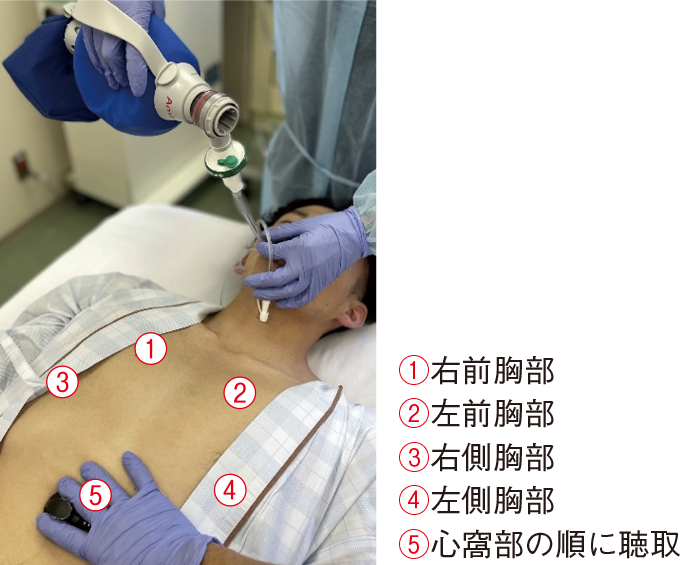 気管挿管の準備と評価 | 看護roo![カンゴルー]